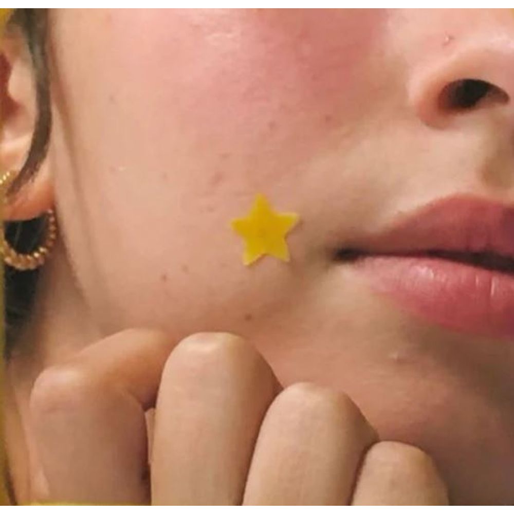 Parches para Acné Zafira modelo Estrella | plazaVea - Supermercado